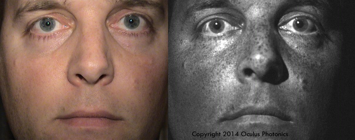 Imaging Sun Damage on Skin and Sunscreen | Oculus Photonics
